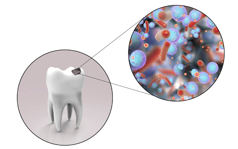 What is the Role of Probiotics in Oral Health?
