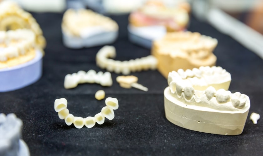 Dental Bridge Fell Out? Here's What To Do Fast!