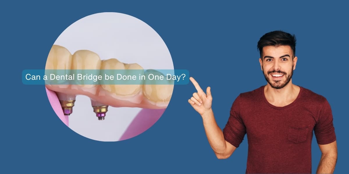 Know How to Get a Dental Bridge in One Day